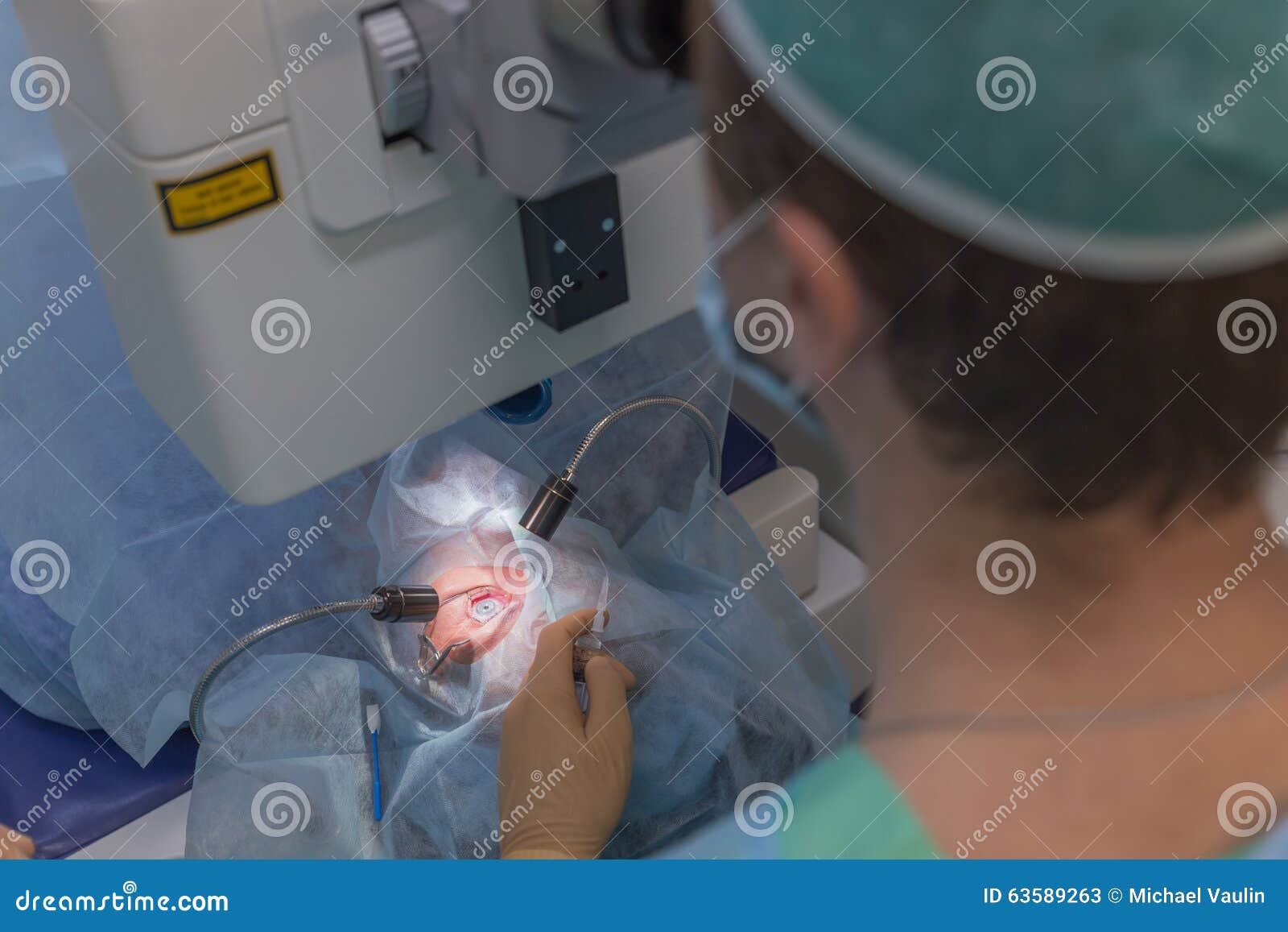 Opthtalmology Laser Operation Editorial Stock Photo - Image of ...