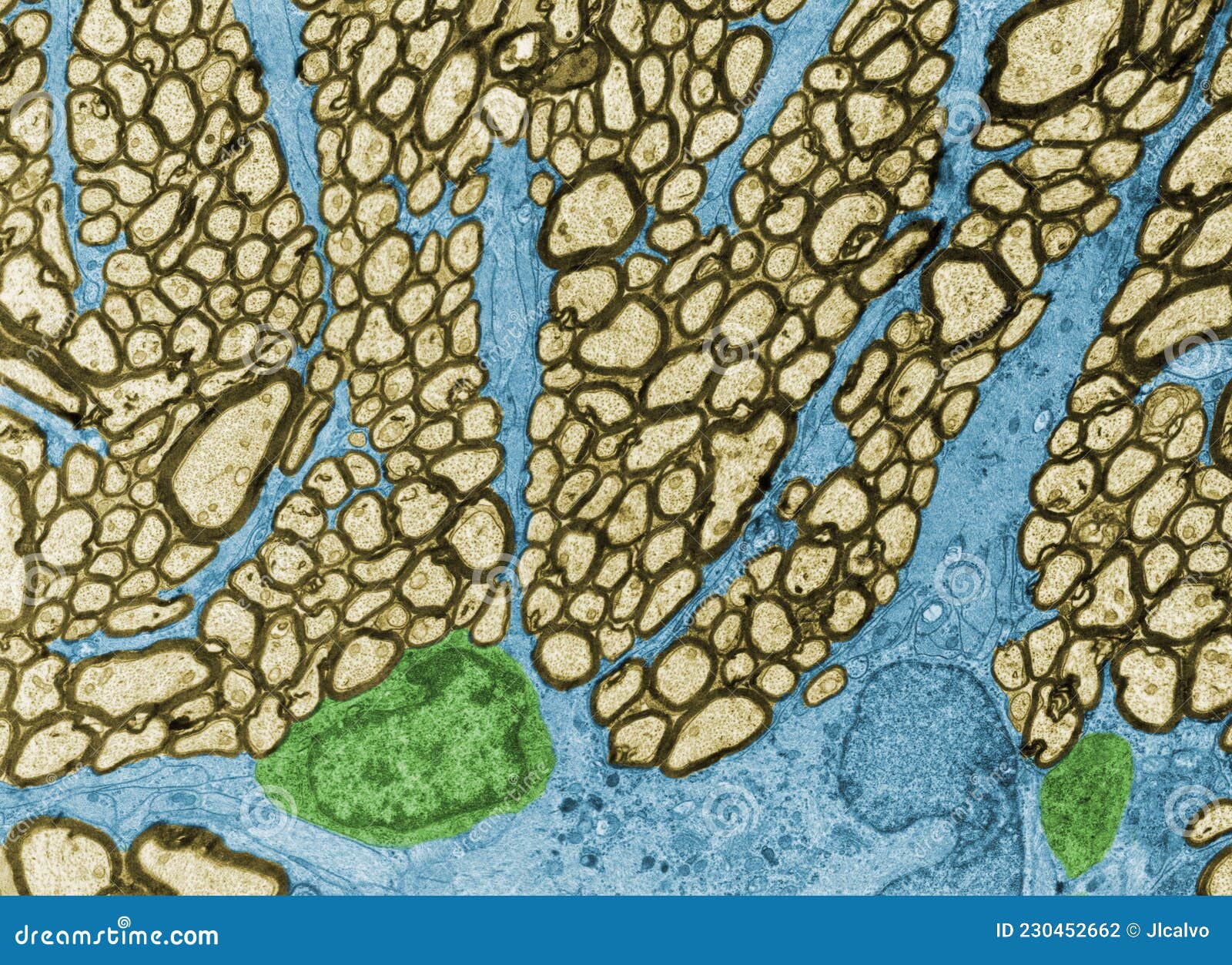 Optic nerve glia stock photo. Image of cell, coloured - 230452662