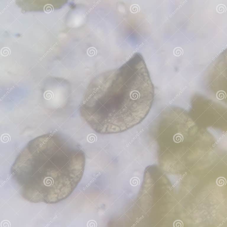 Pollen Under the Microscope Stock Image - Image of botanical, plant ...