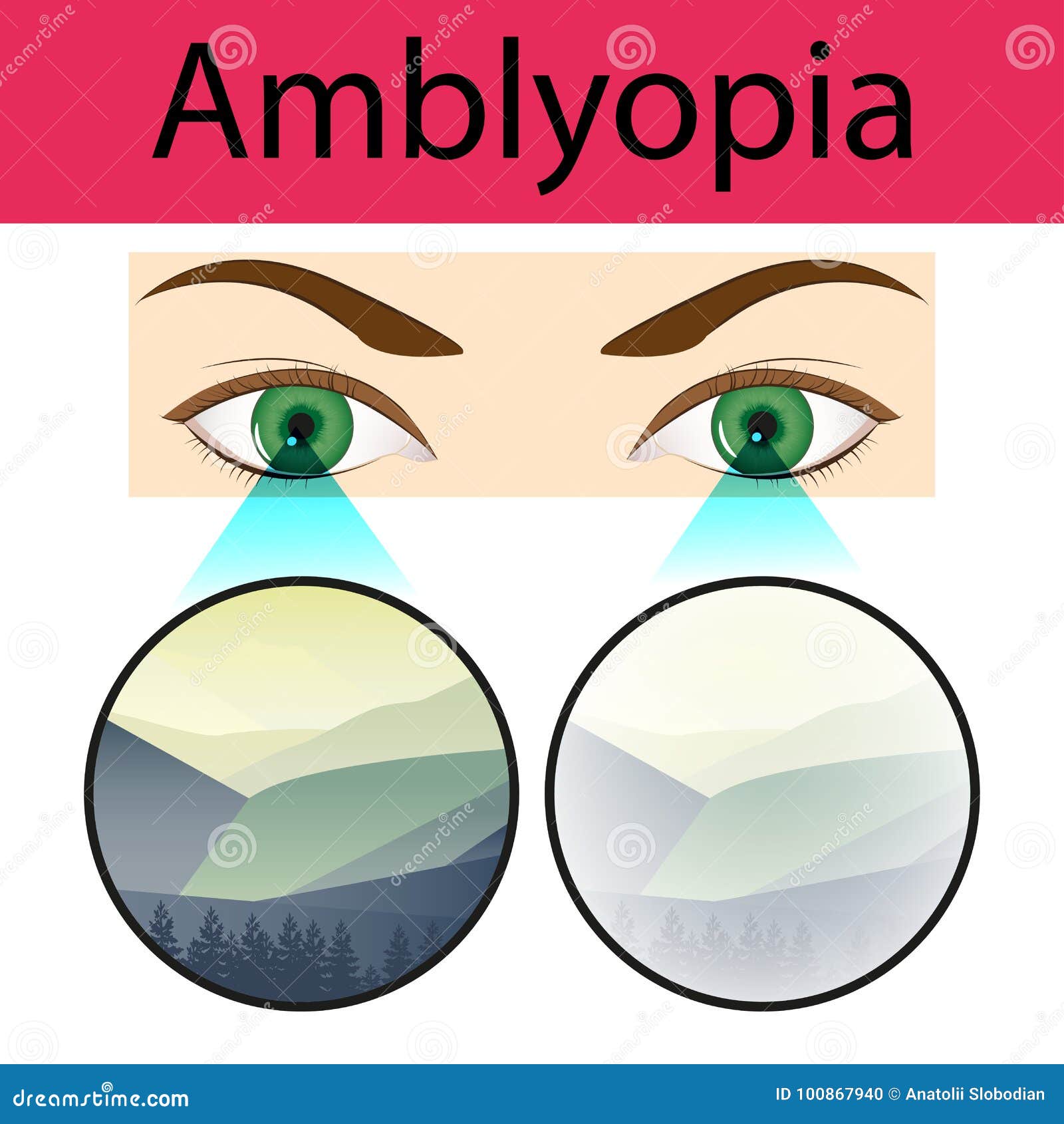 Optician Eye Vision Vector Logo Illustration. Creative Optic Symbol ...