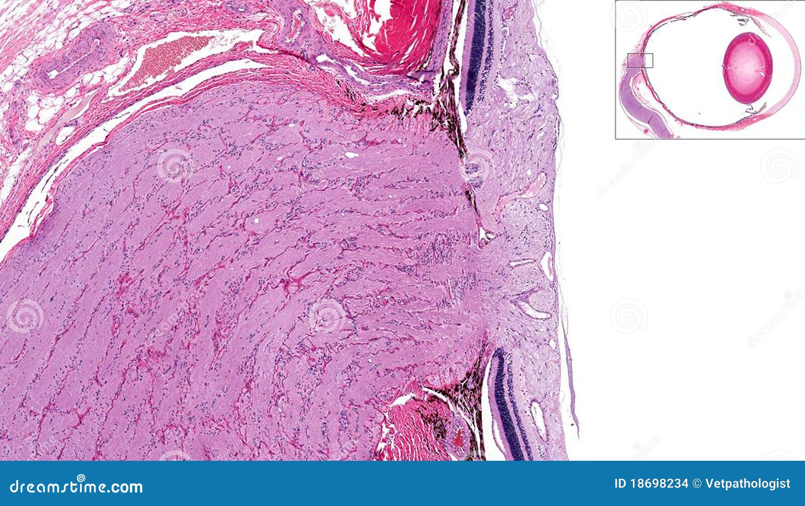 Optische zenuw en retina stock foto. Image of lens, blindheid - 18698234