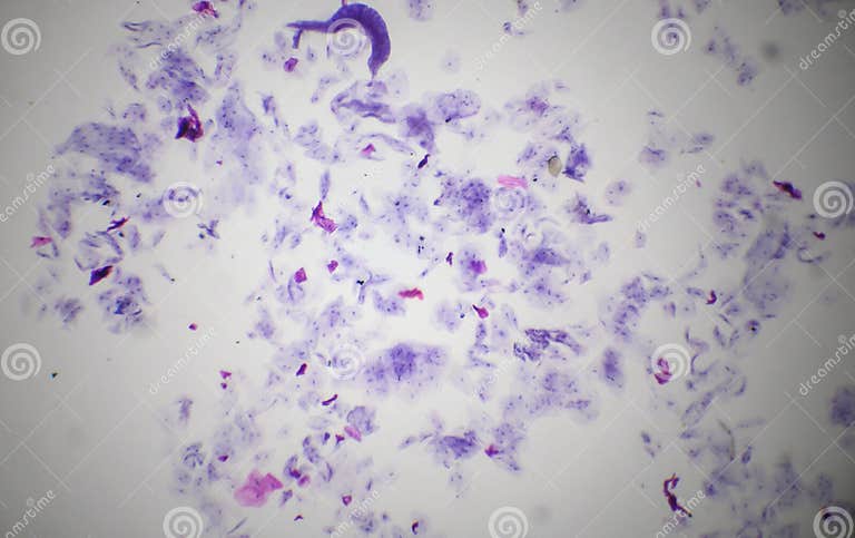 Oral Cavity Mucous Membrane Under the Microscope Stock Image - Image of ...