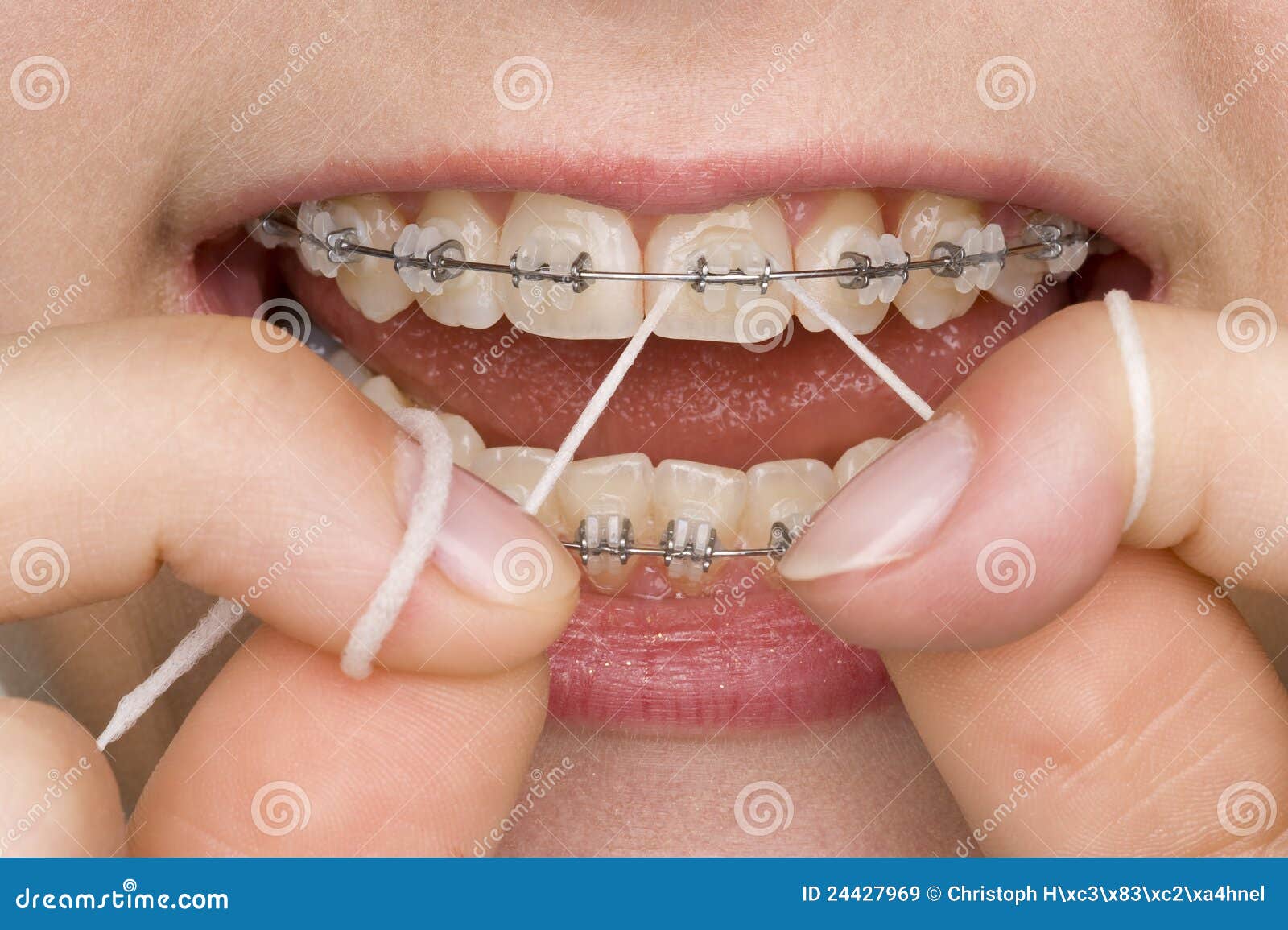 Oral hygiene stock image. Image of dentist, health, bacterial - 24427969