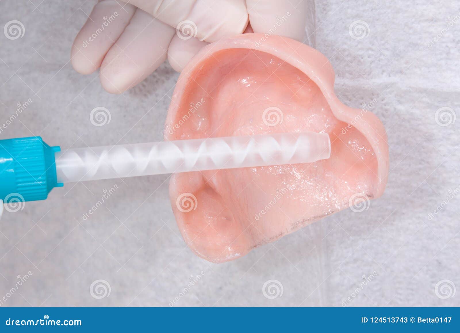 Oral Rehabilitation Process, Partial Removable Prosthesis Stock Image ...