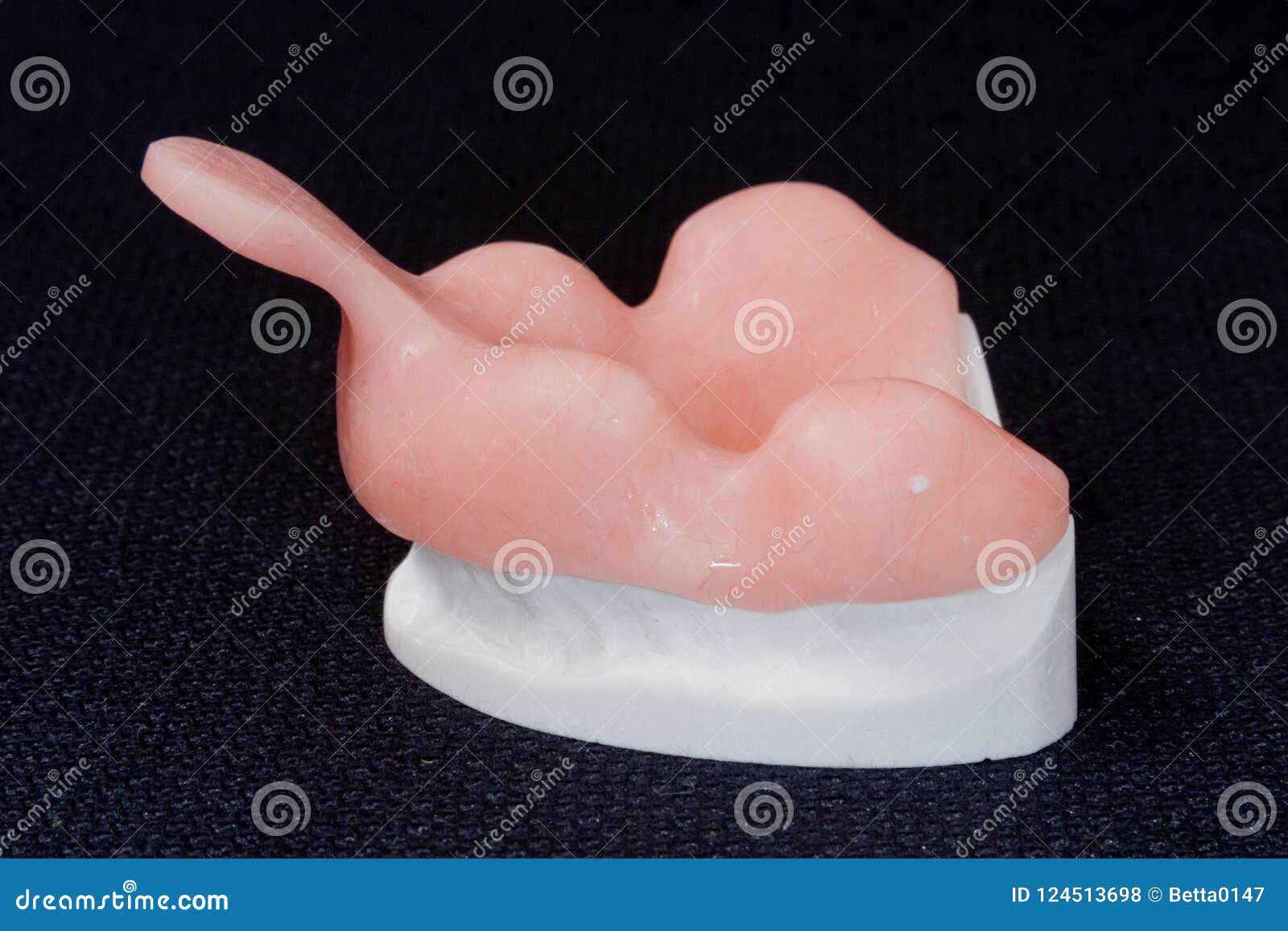 Oral Rehabilitation Process, Partial Removable Prosthesis Stock Photo ...
