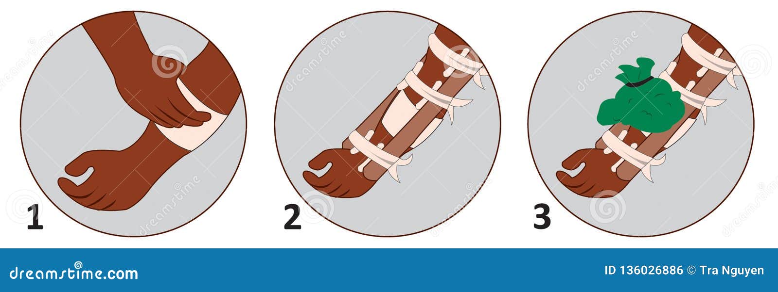 How To Apply Common First Aid Situation Stock Illustration ...