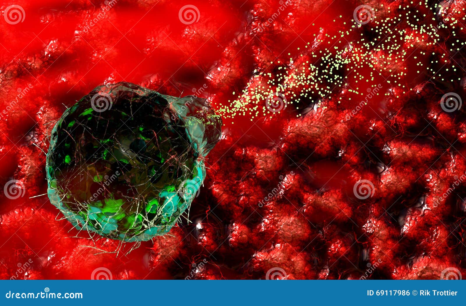 Rupturing Cartoons, Illustrations & Vector Stock Images - 31 Pictures ...