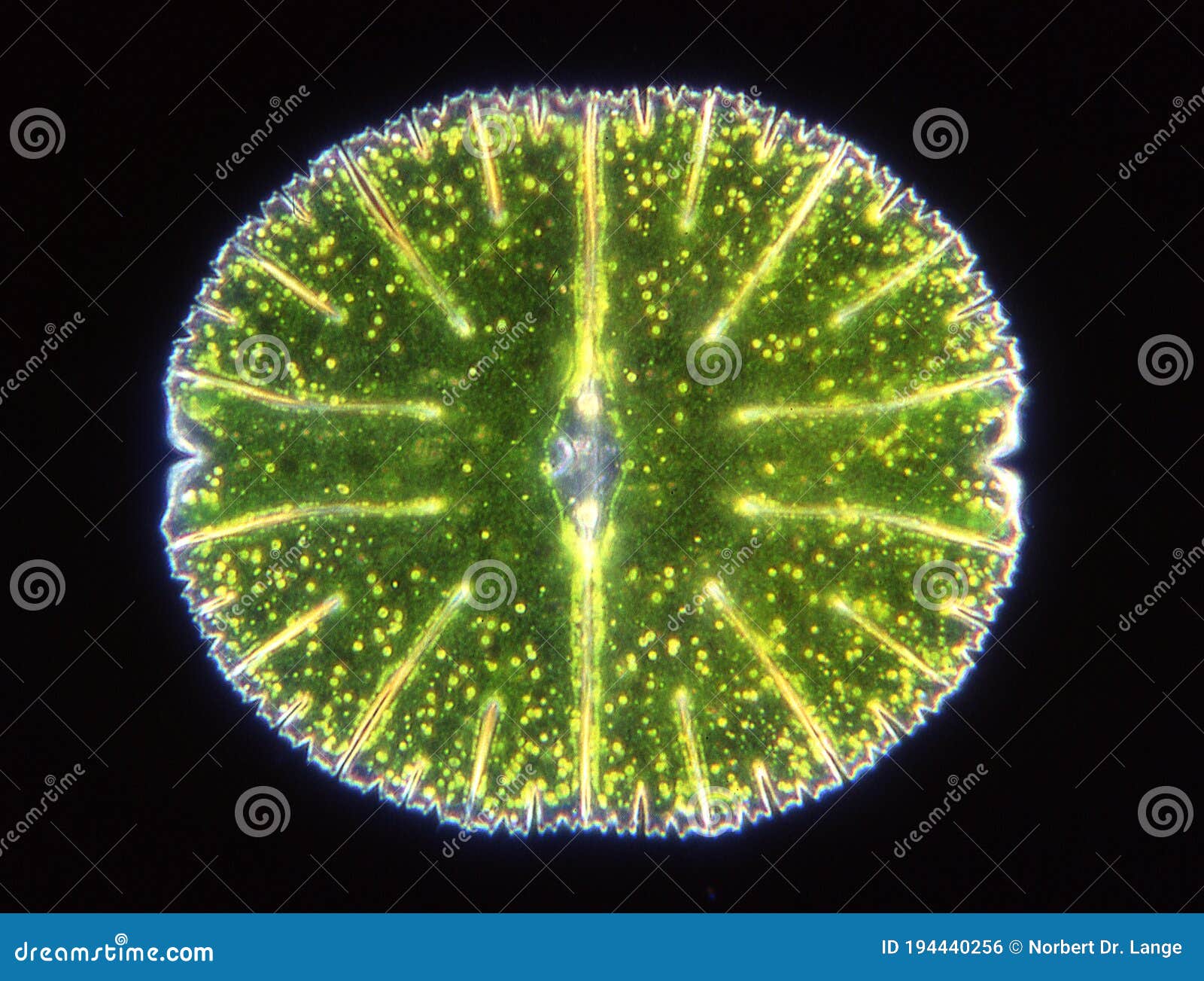 Ornamental Algae Micrasterias Under the Microscope Stock Photo - Image ...