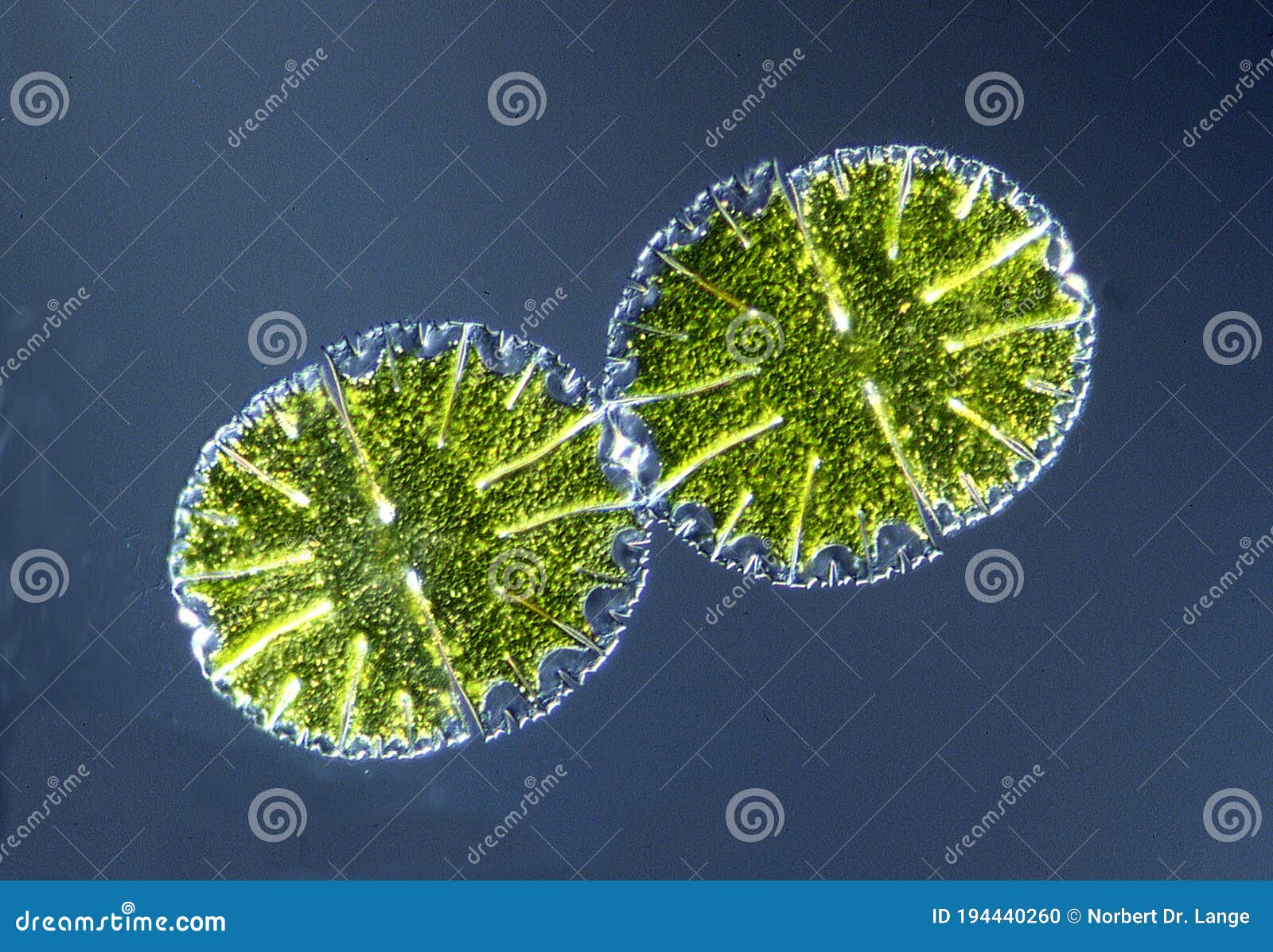 Ornamental Algae Micrasterias Under the Microscope Stock Photo - Image ...