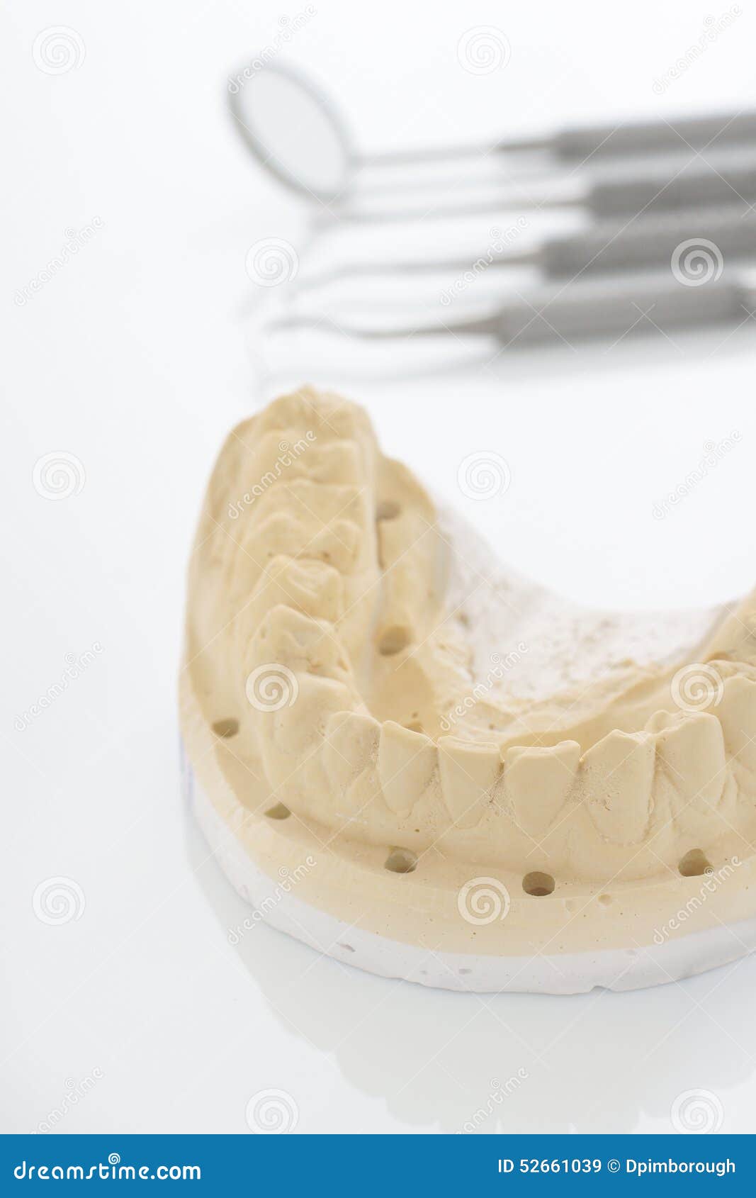 Orthodontic Cast Of Human Jaw For Prosthetics And Braces.Ceramic Crown ...