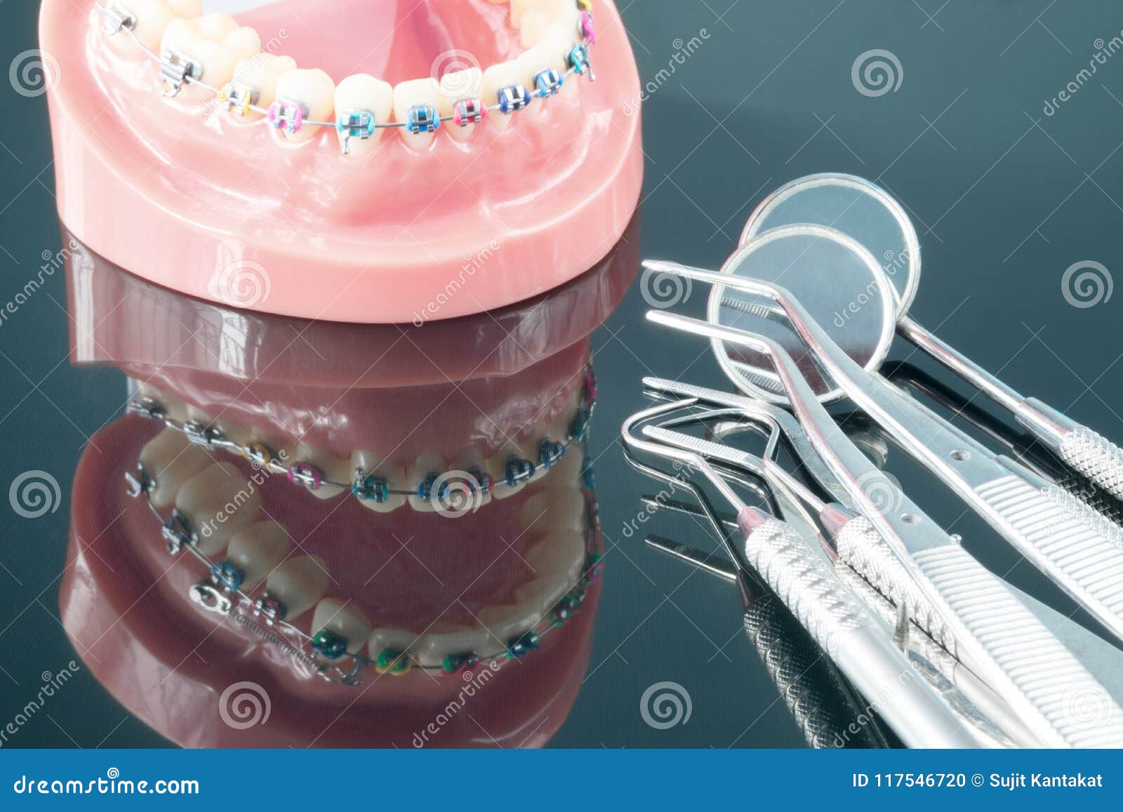 Orthodontic model. stock photo. Image of dentists, concept - 117546720