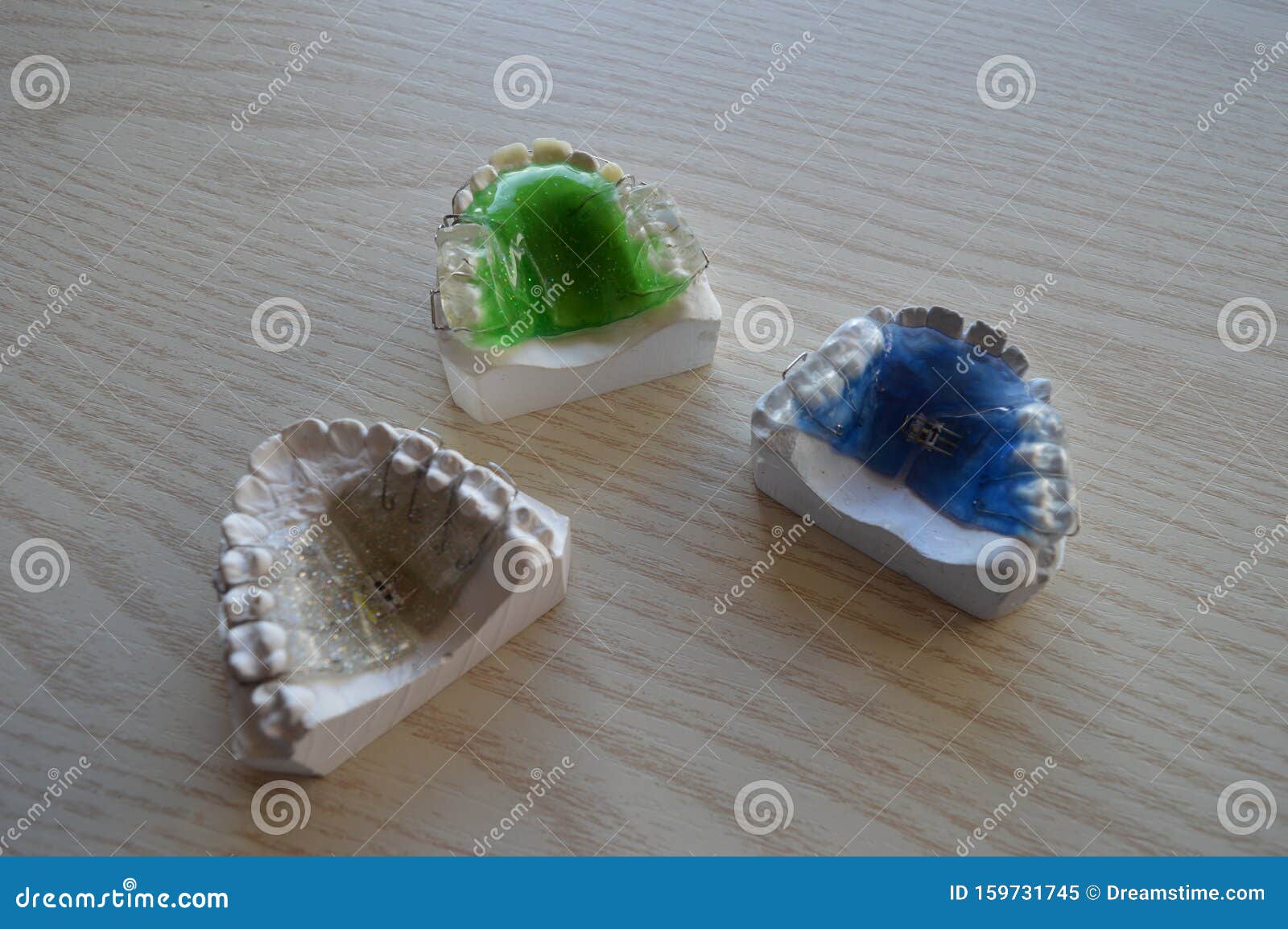 Orthodontic Teeth Alignment Plate Stock Image - Image of bite ...