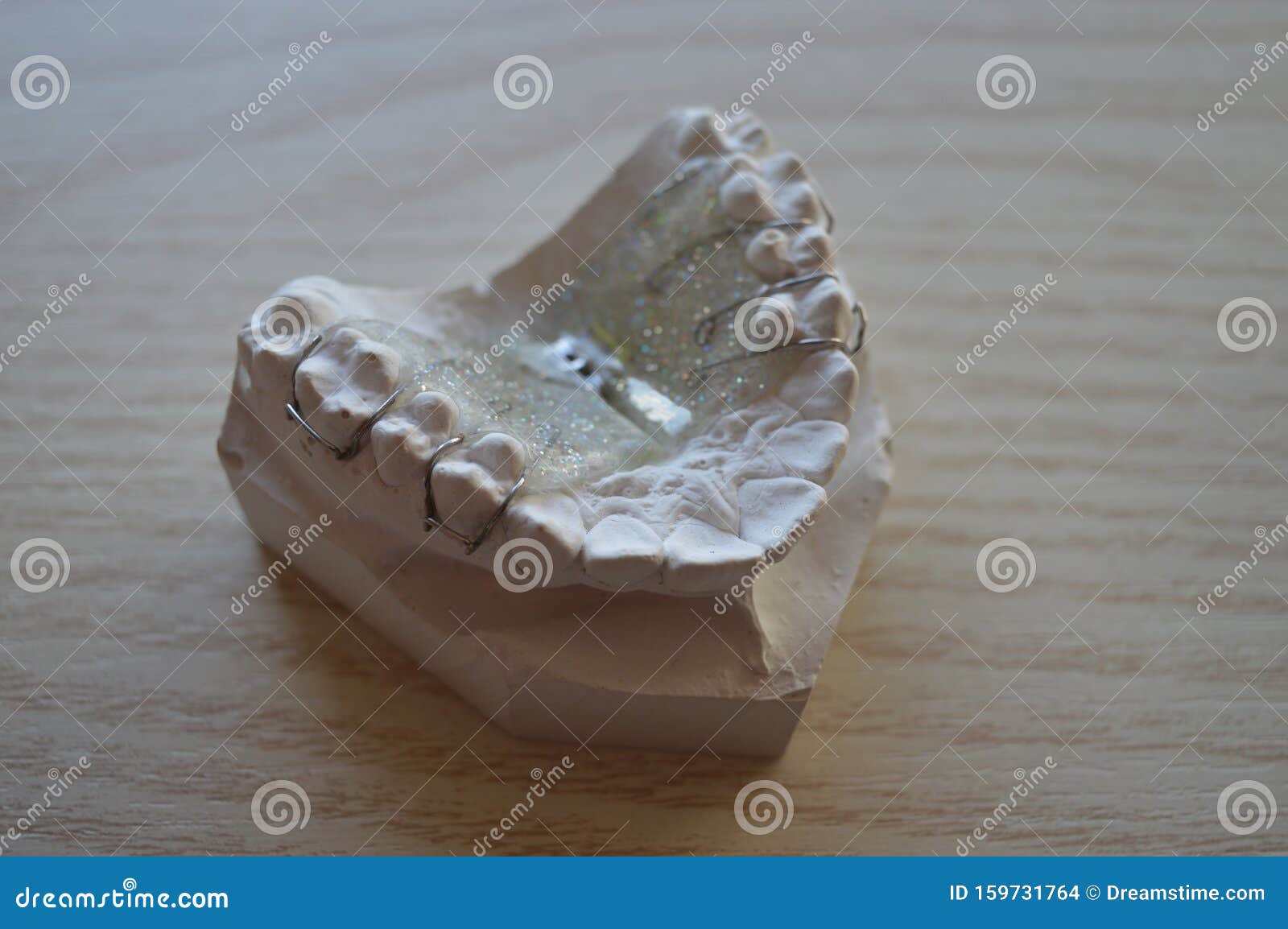 Orthodontic Teeth Alignment Plate Stock Photo - Image of instrument ...