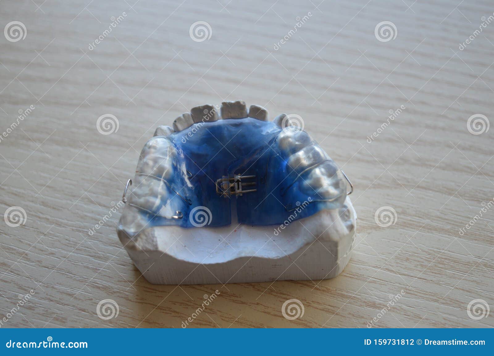 Orthodontic Teeth Alignment Plate Stock Photo - Image of dental ...