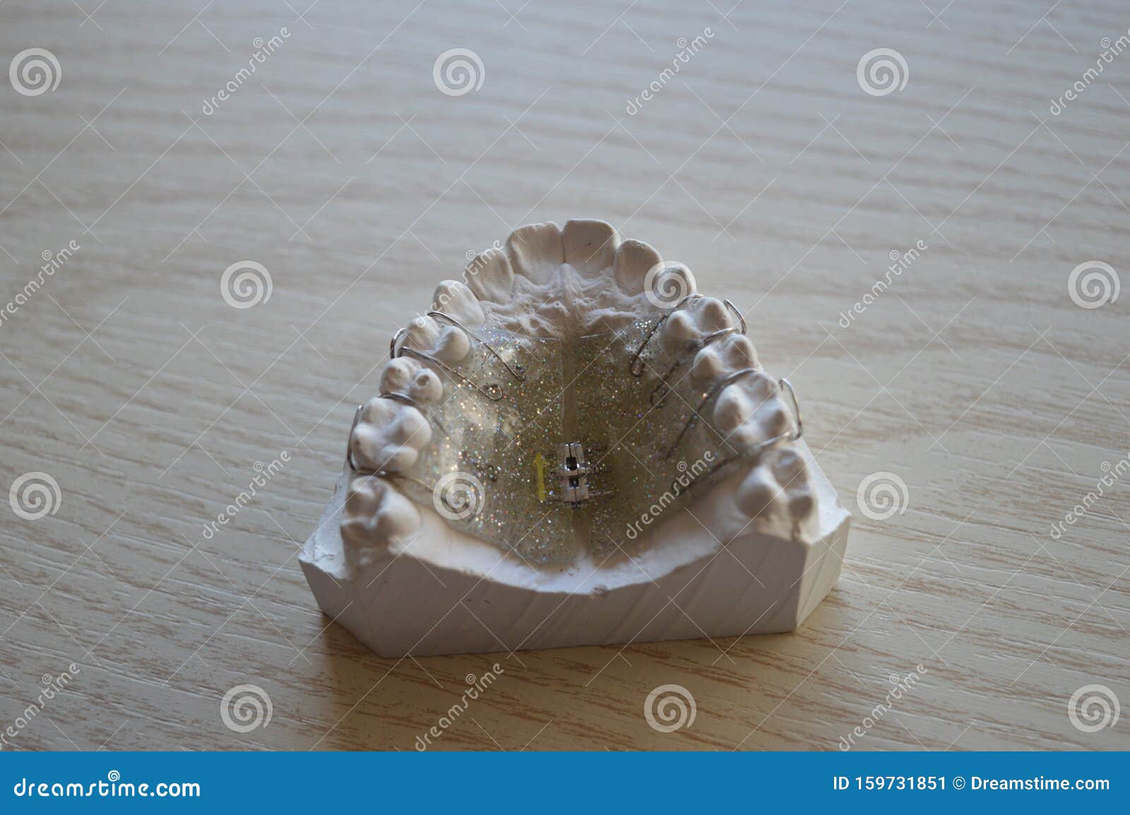 Orthodontic Teeth Alignment Plate Stock Image - Image of orthodontia ...