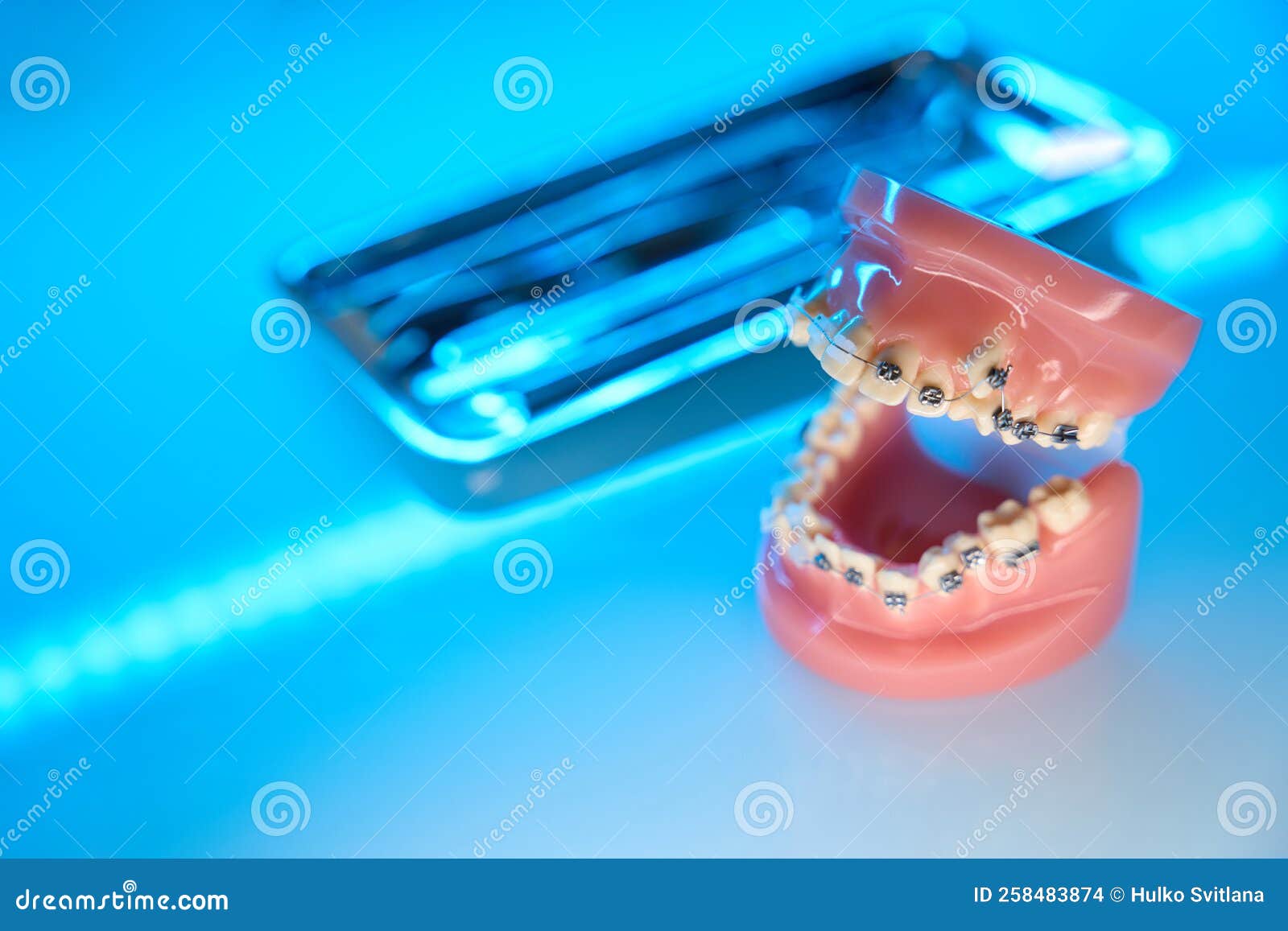 Orthodontic Tools for Teeth Alignment. Jaw with Braces Stock Photo ...