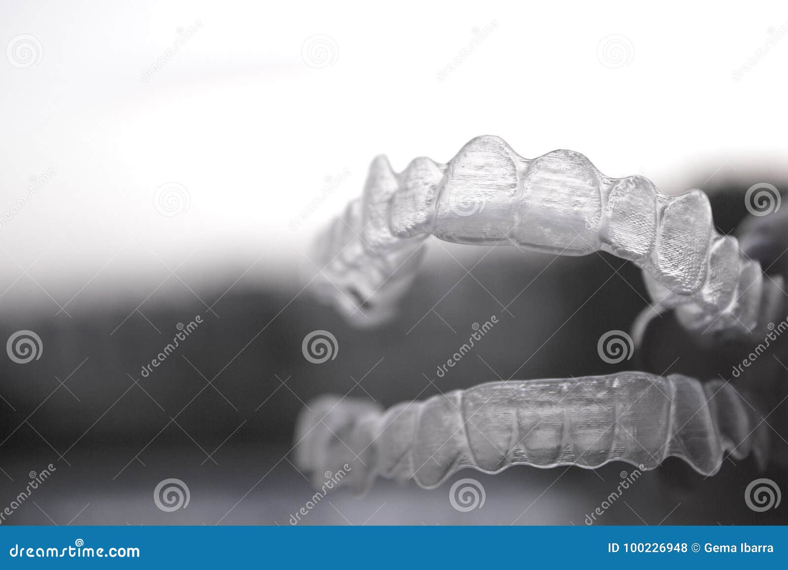 Orthodontics To Correct Alignment of Teeth Stock Photo - Image of align ...