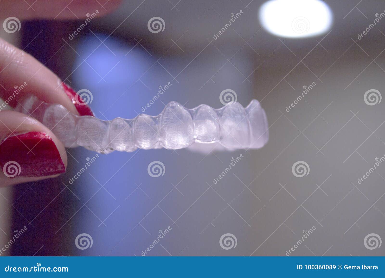 Orthodontics To Correct Alignment of Teeth Stock Image - Image of ...