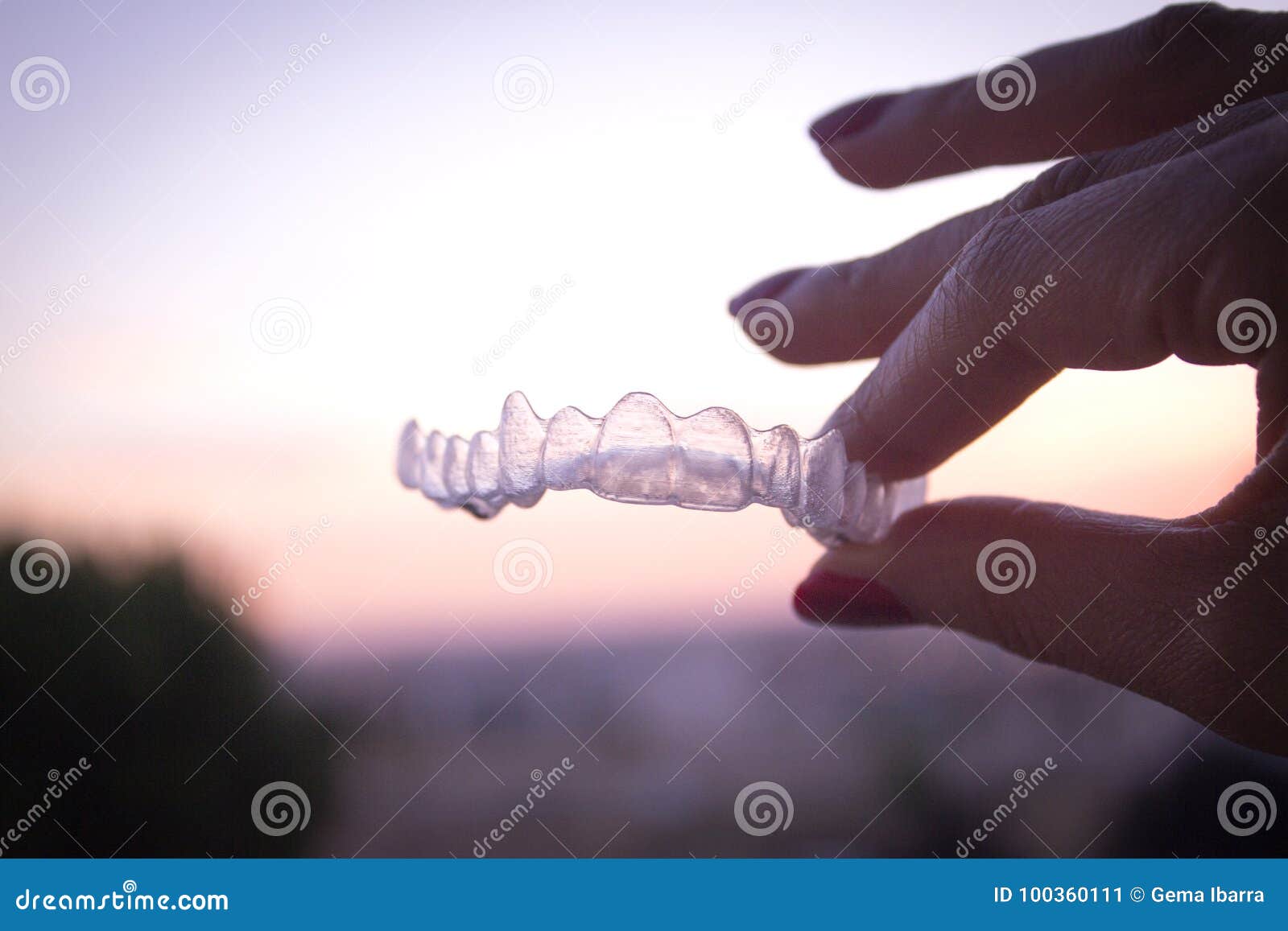 Orthodontics To Correct Alignment of Teeth Stock Image - Image of mouth ...