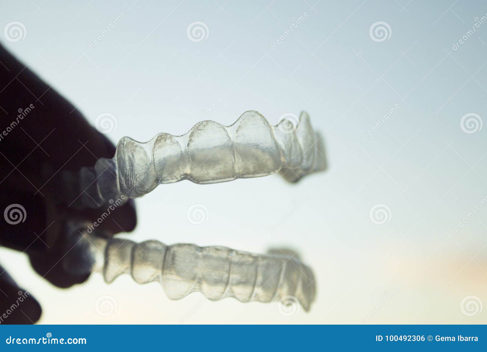 Orthodontics To Correct Alignment of Teeth Stock Photo - Image of ...