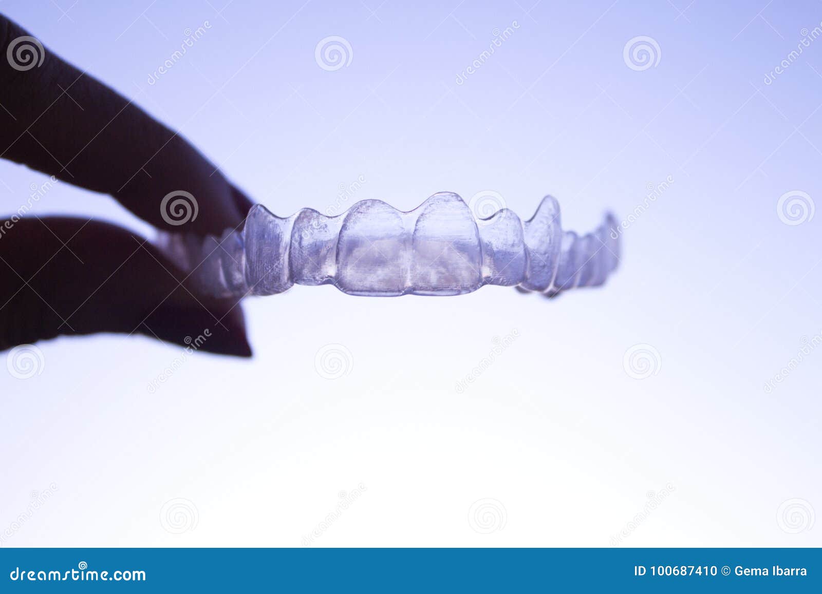 Orthodontics To Correct Alignment of Teeth Stock Photo - Image of ...