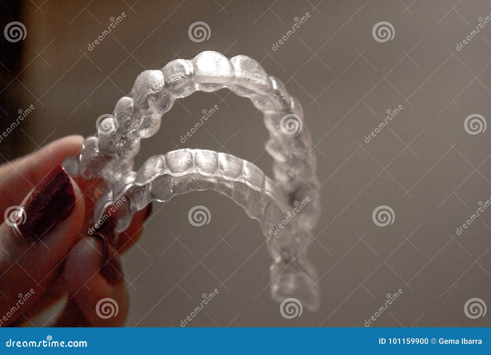 Orthodontics To Correct Alignment of Teeth Stock Photo - Image of ...