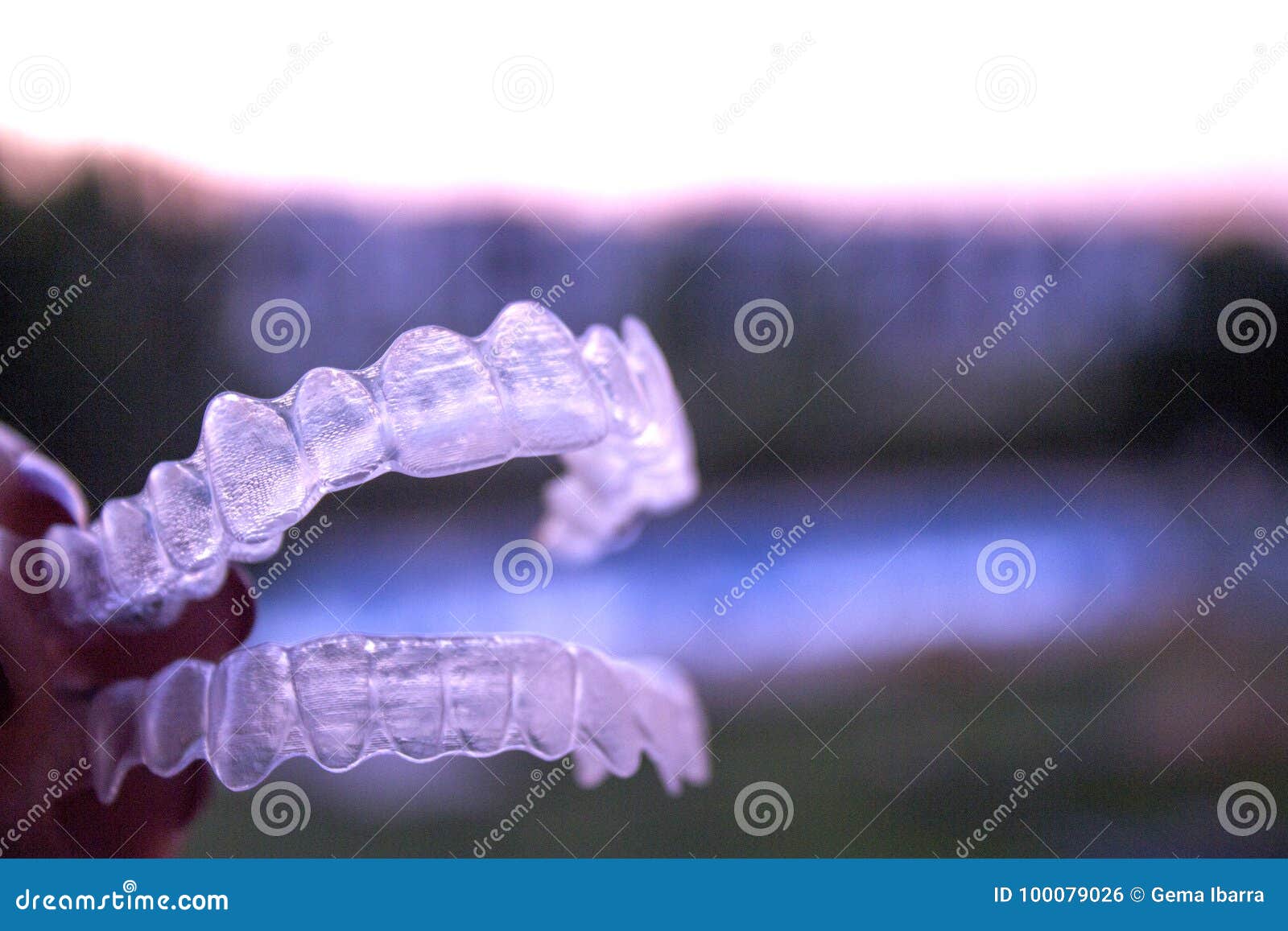 Orthodontics To Correct Alignment of Teeth Stock Photo - Image of ...