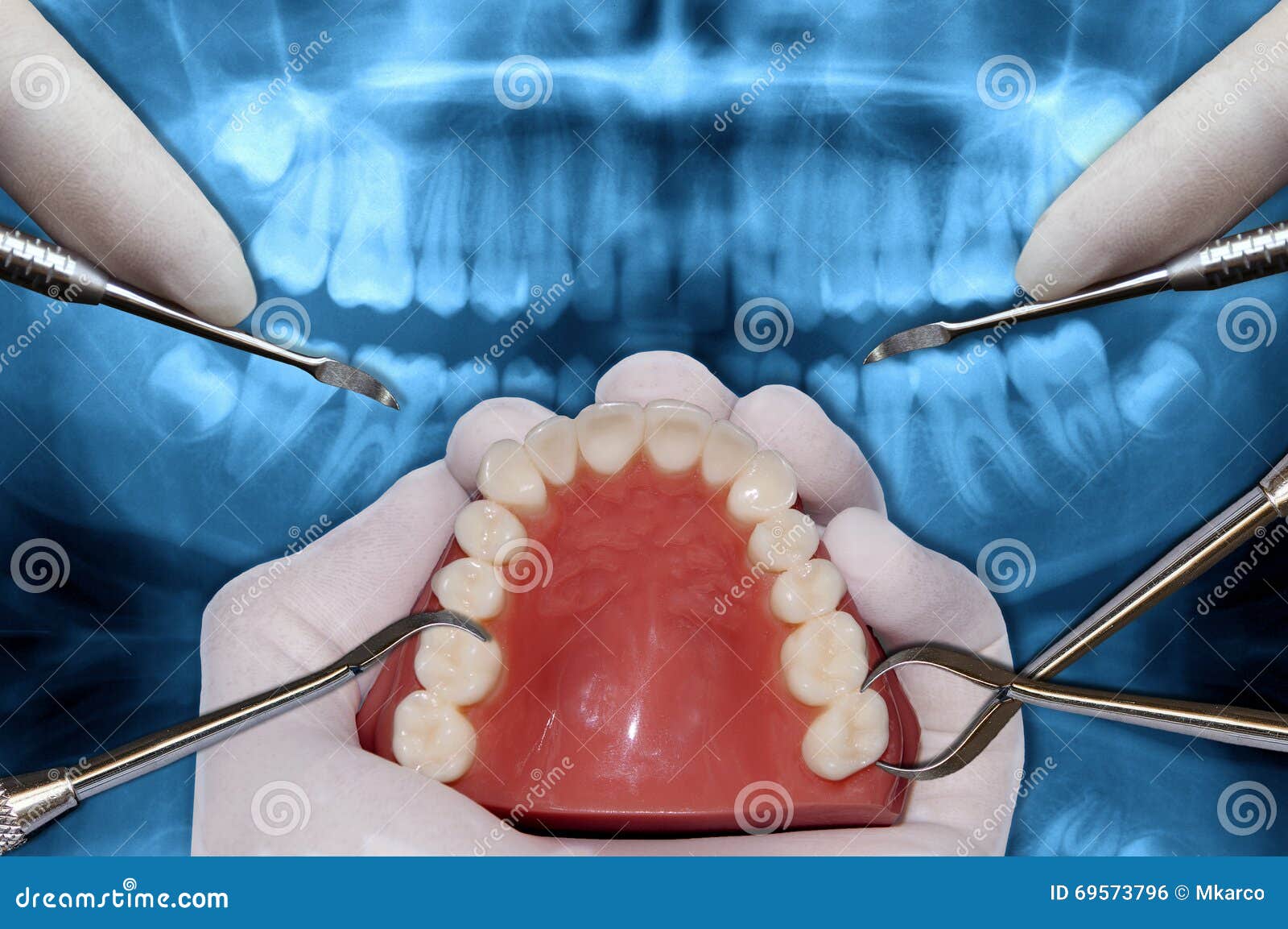Surgical Orthodontics Prosthodontics Teeth Implant Royalty-Free Stock ...