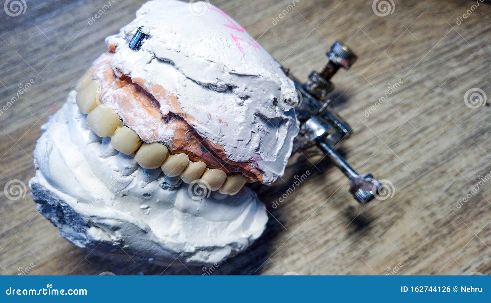 Orthodontist Dentist, Dental Prosthesis Making Process Stock Photo ...