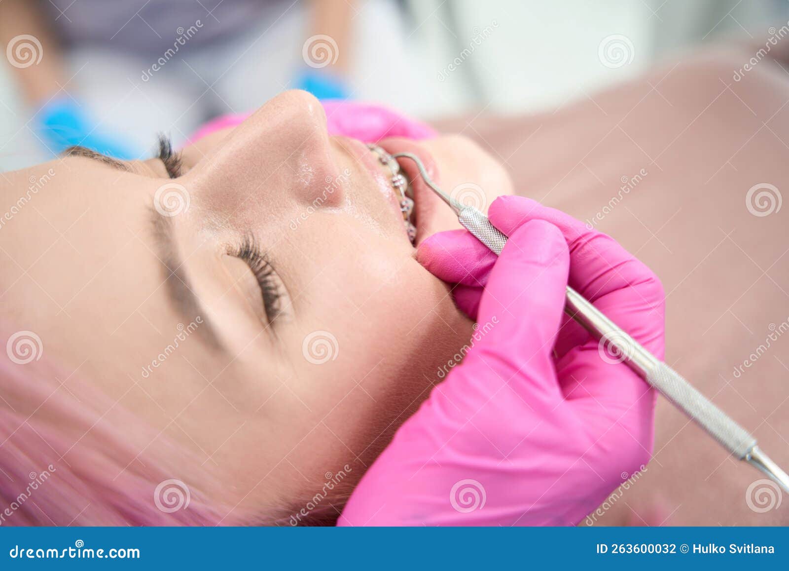 Orthodontist Performs Maintenance of Bracket System for Aligning ...