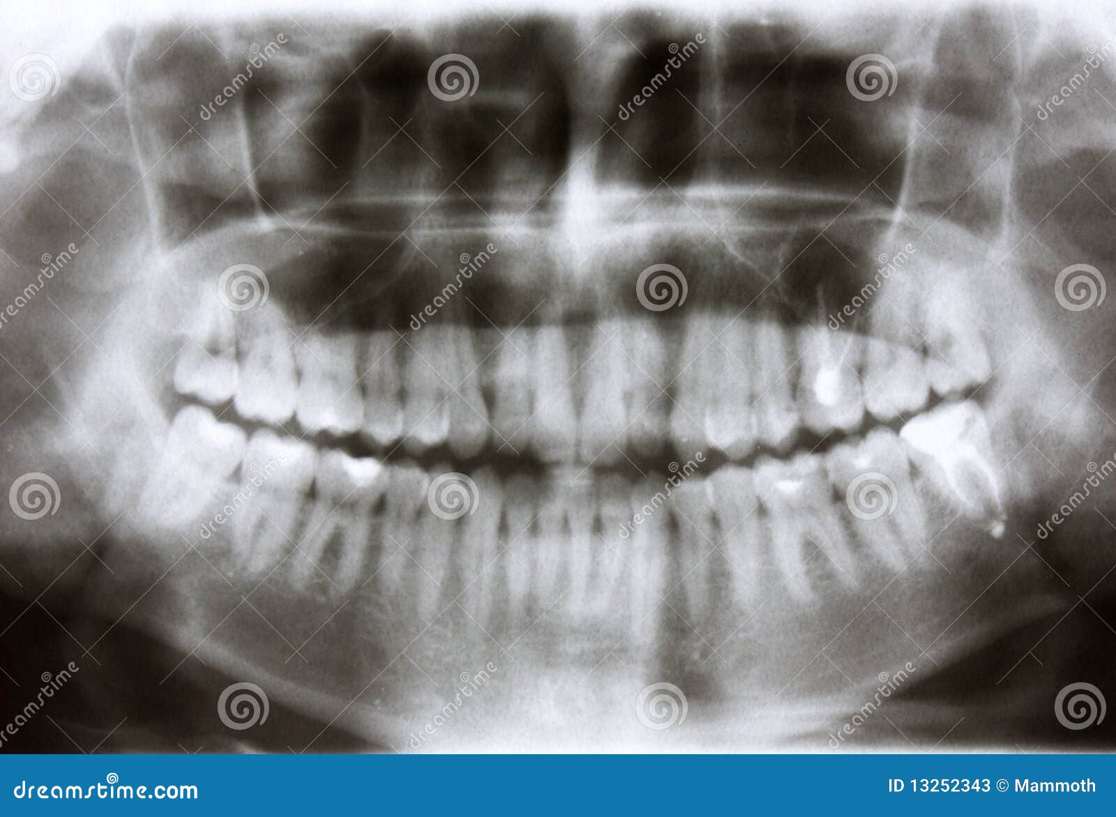 Orthopantomogram stock image. Image of equipment, technology - 13252343