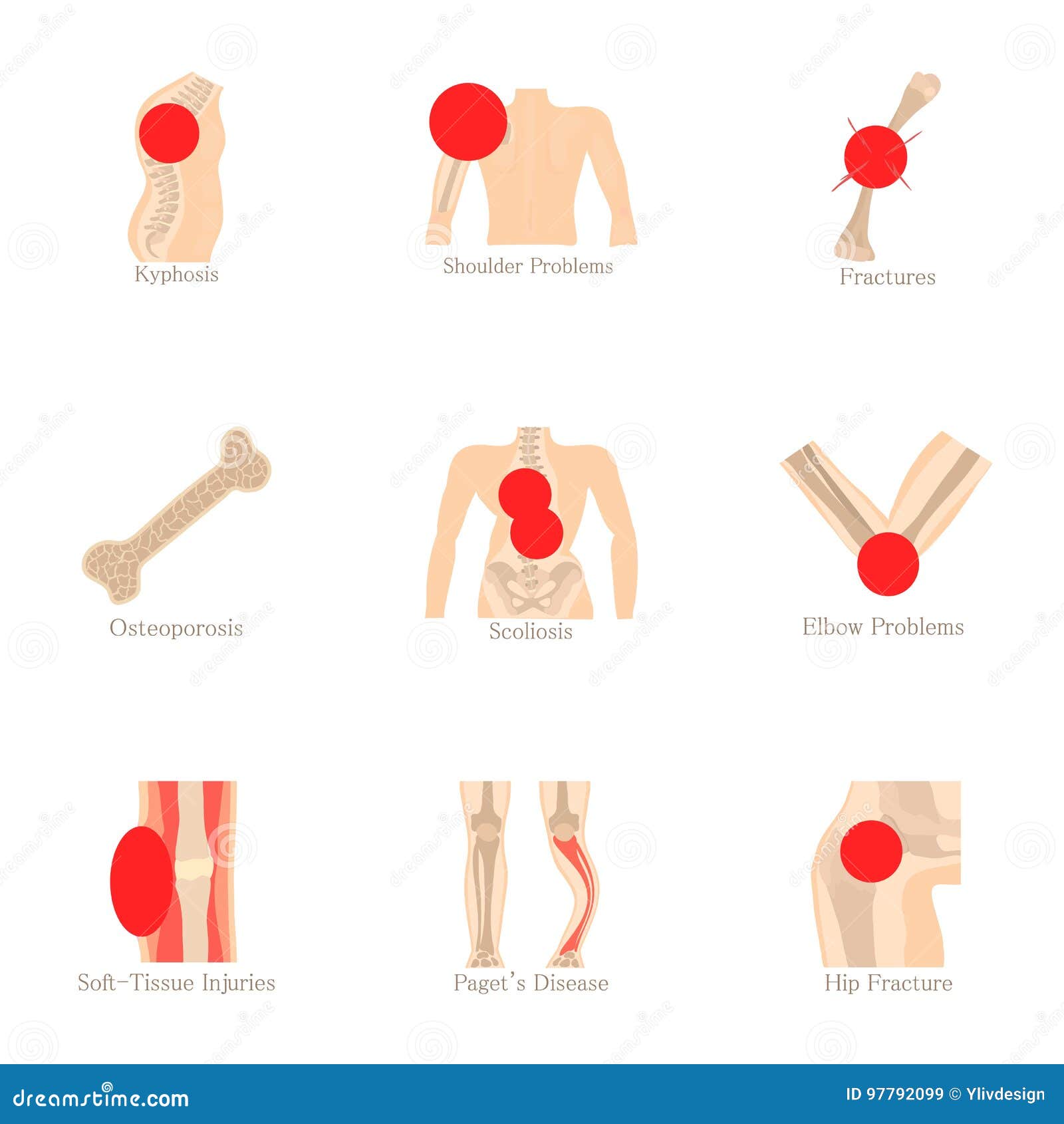 Orthopedic Icons Set, Cartoon Style Stock Vector - Illustration of ...