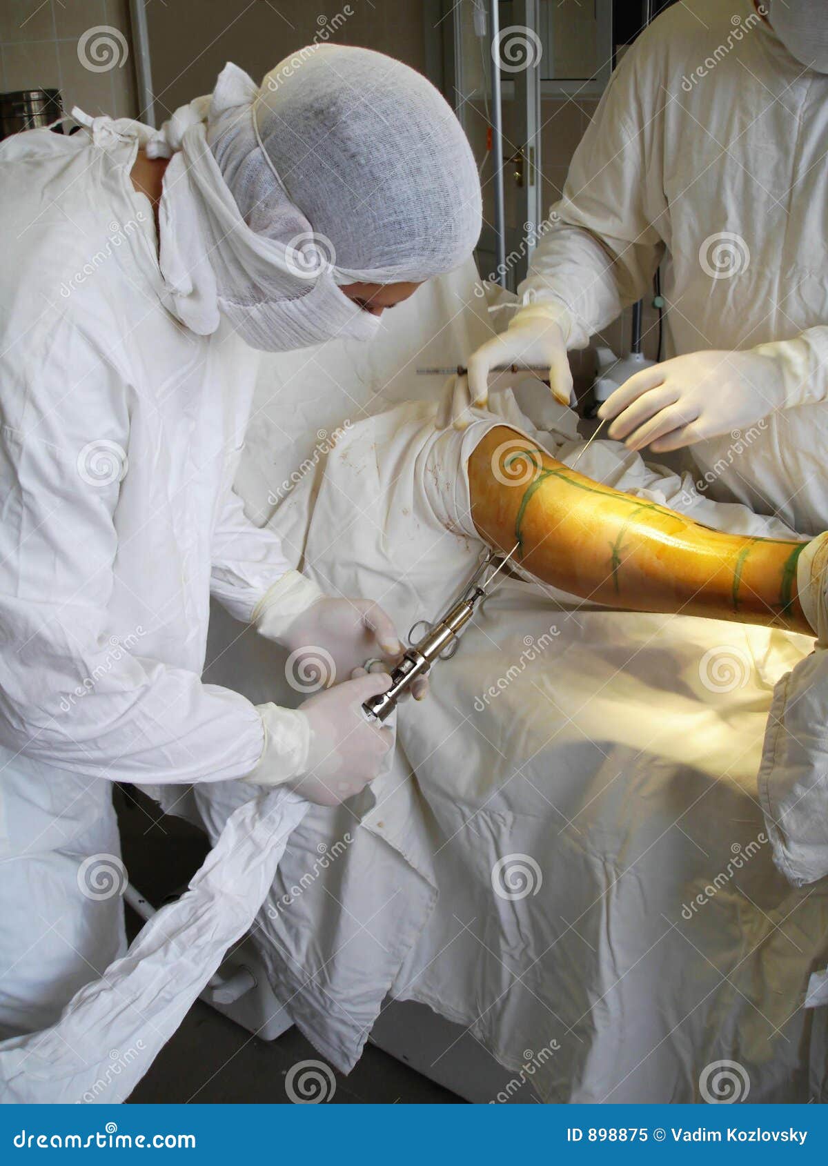 Orthopedic operation stock image. Image of instruments - 898875