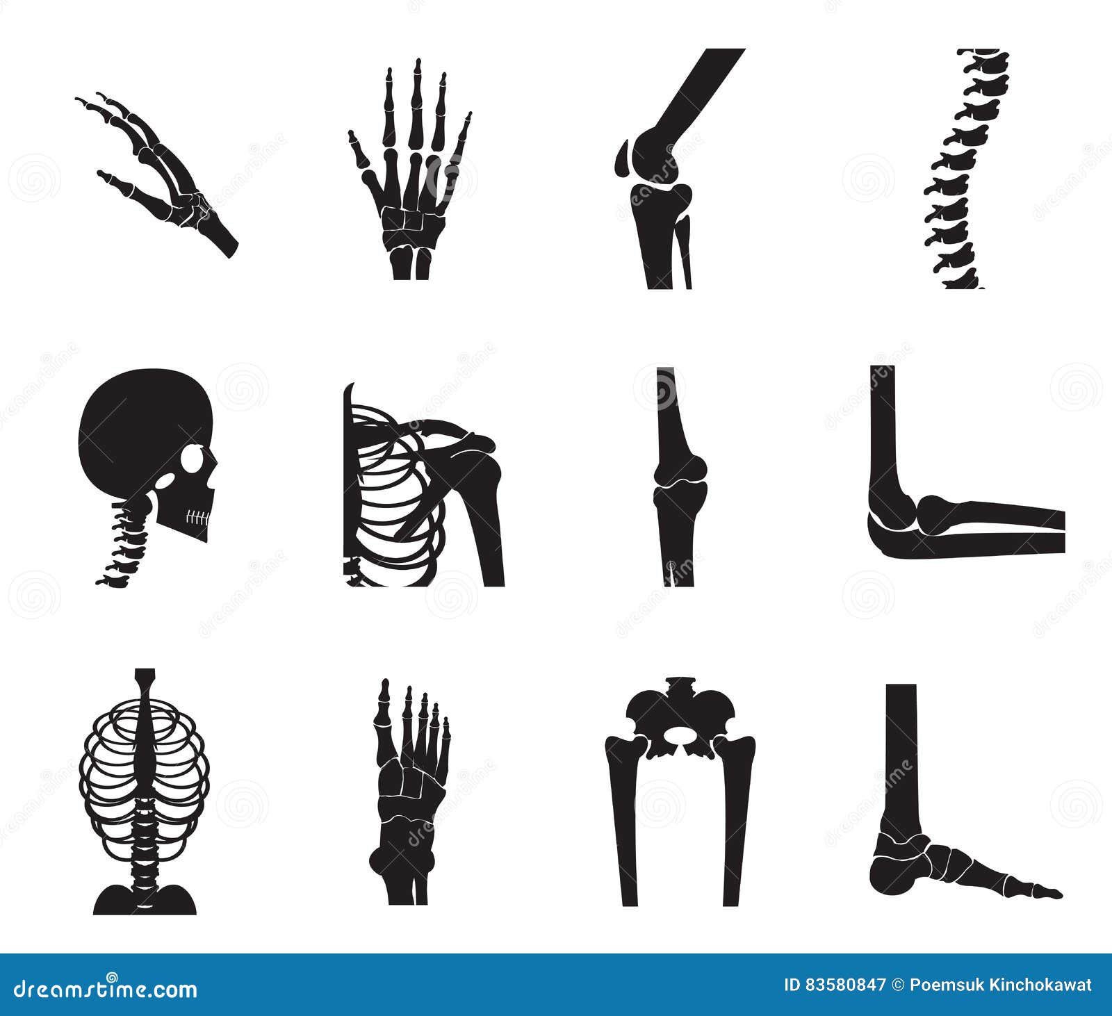 Orthopedic Skeleton