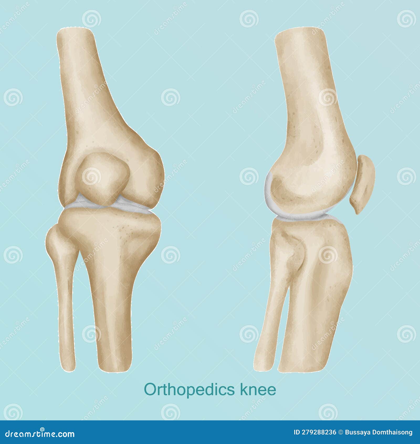 Orthopedics Knee Icon An Injury Of ACL Or Anterior Cruciate Ligament ...