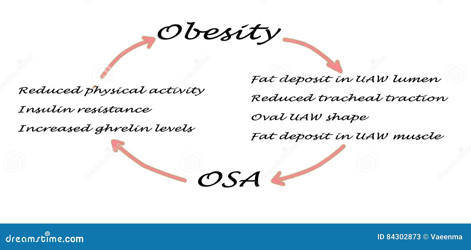 OSA and obesity stock illustration. Illustration of deposit - 84302873