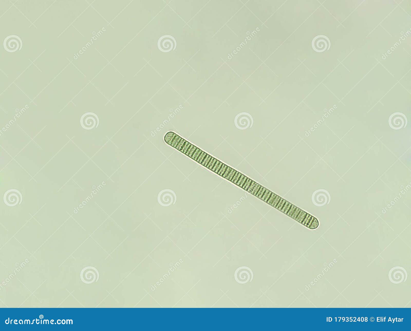 Oscillatoria Sp. Algae Under Microscopic View Stock Photo - Image of microbiology, blue: 179352408