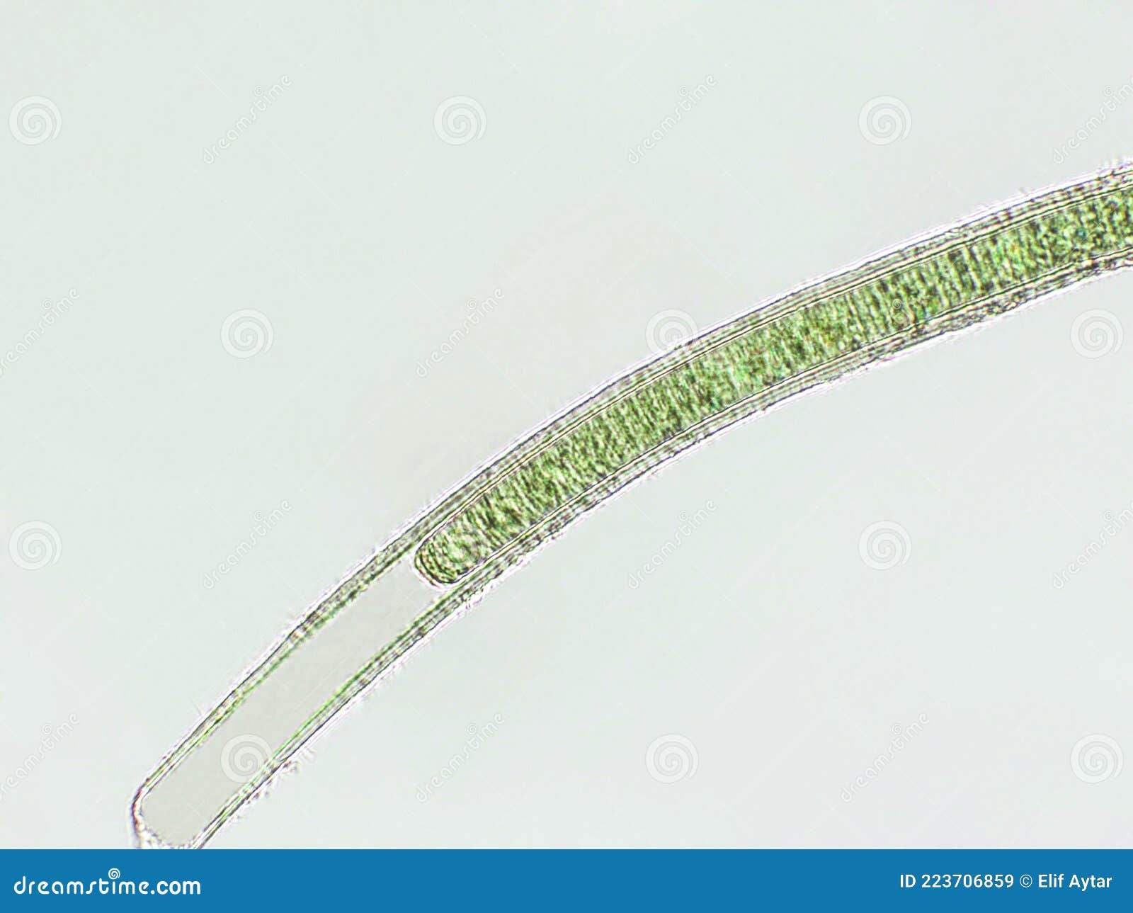 Oscillatoria Sp. Algae Under Microscopic View X40 Stock Image - Image ...
