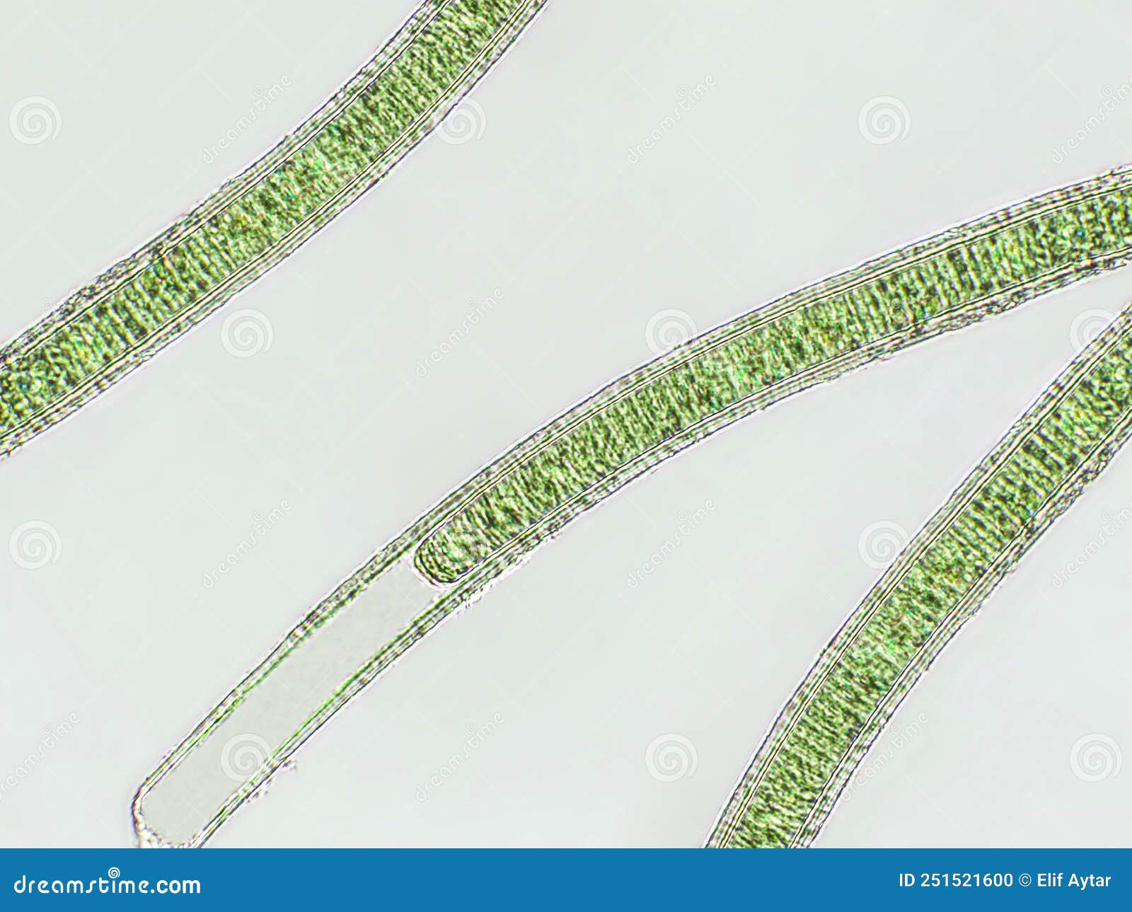 Oscillatoria Sp. Algae Under Microscopic View X40 Stock Photo - Image ... Oscillatoria Sp. Algae Under Microscopic View X40 Stock Photo - Image ...