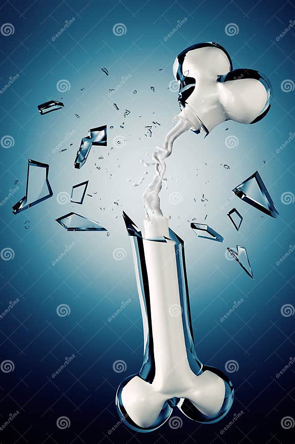 Osso rotto illustrazione di stock. Illustrazione di calcio - 23570241