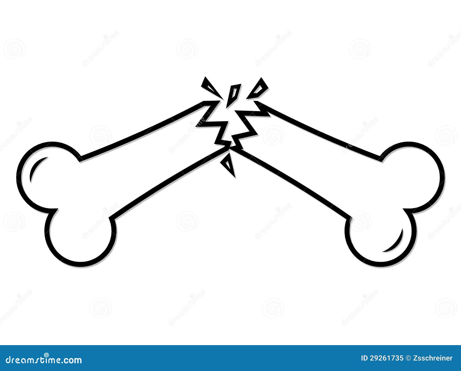 Osso rotto illustrazione di stock. Illustrazione di umano - 29261735
