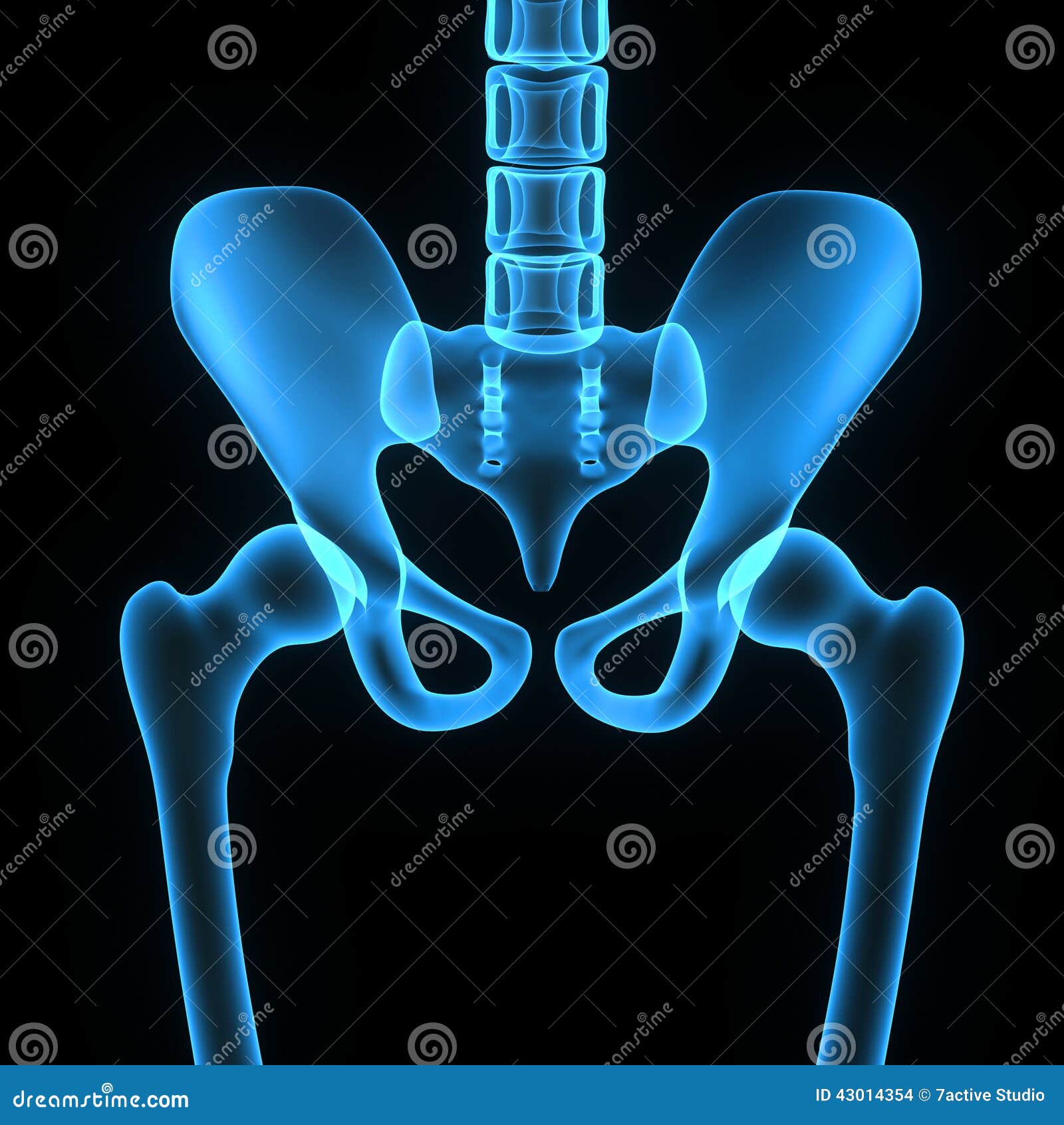 Osteoartritis Van Heupverbinding Stock Illustratie - Illustration of ...