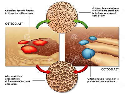 Osteoblast & Osteoclast Stock Vector - Illustration of cell, primary ...