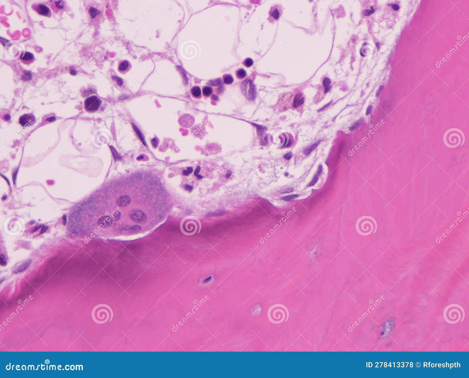 Bone Remodeling Histology