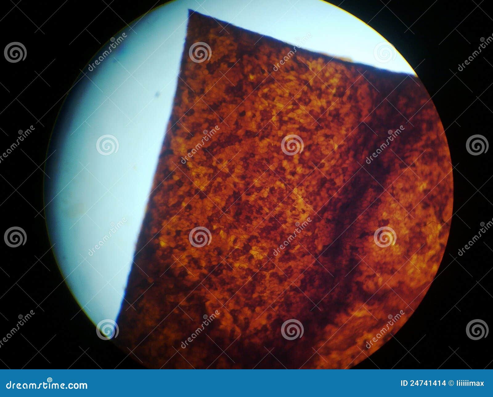 Osteocyte; Osteocytes; Pilha De Osso Foto de Stock - Imagem de ...