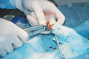 Osteosynthesis with Internal Fixation. the Process of Fixing Pins Stock ...