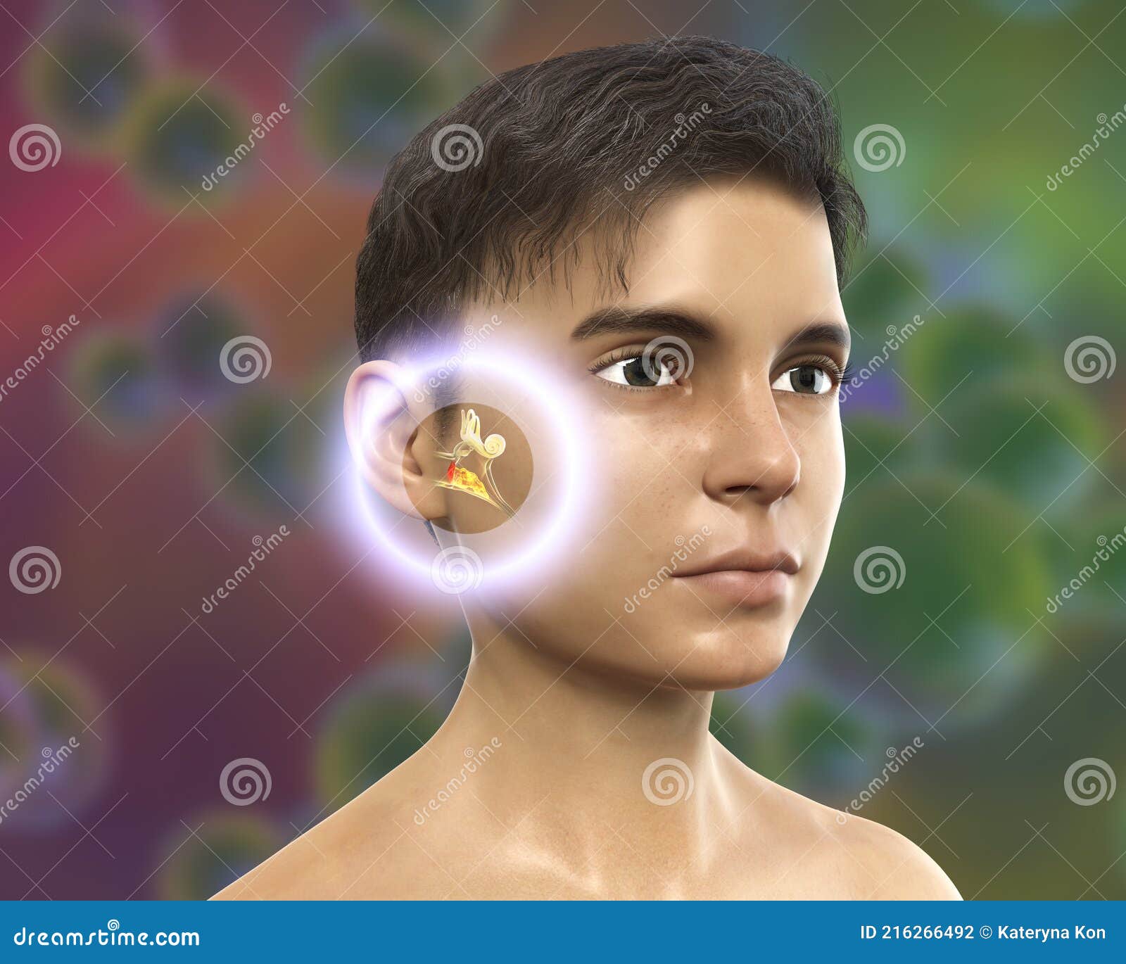Otitis Media A Group Of Inflammatory Diseases Of The Middle Ear Stock Illustration
