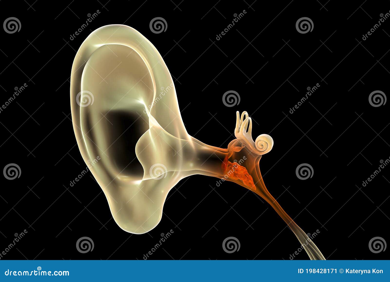 Otitis media, illustration stock illustration. Illustration of medical ...