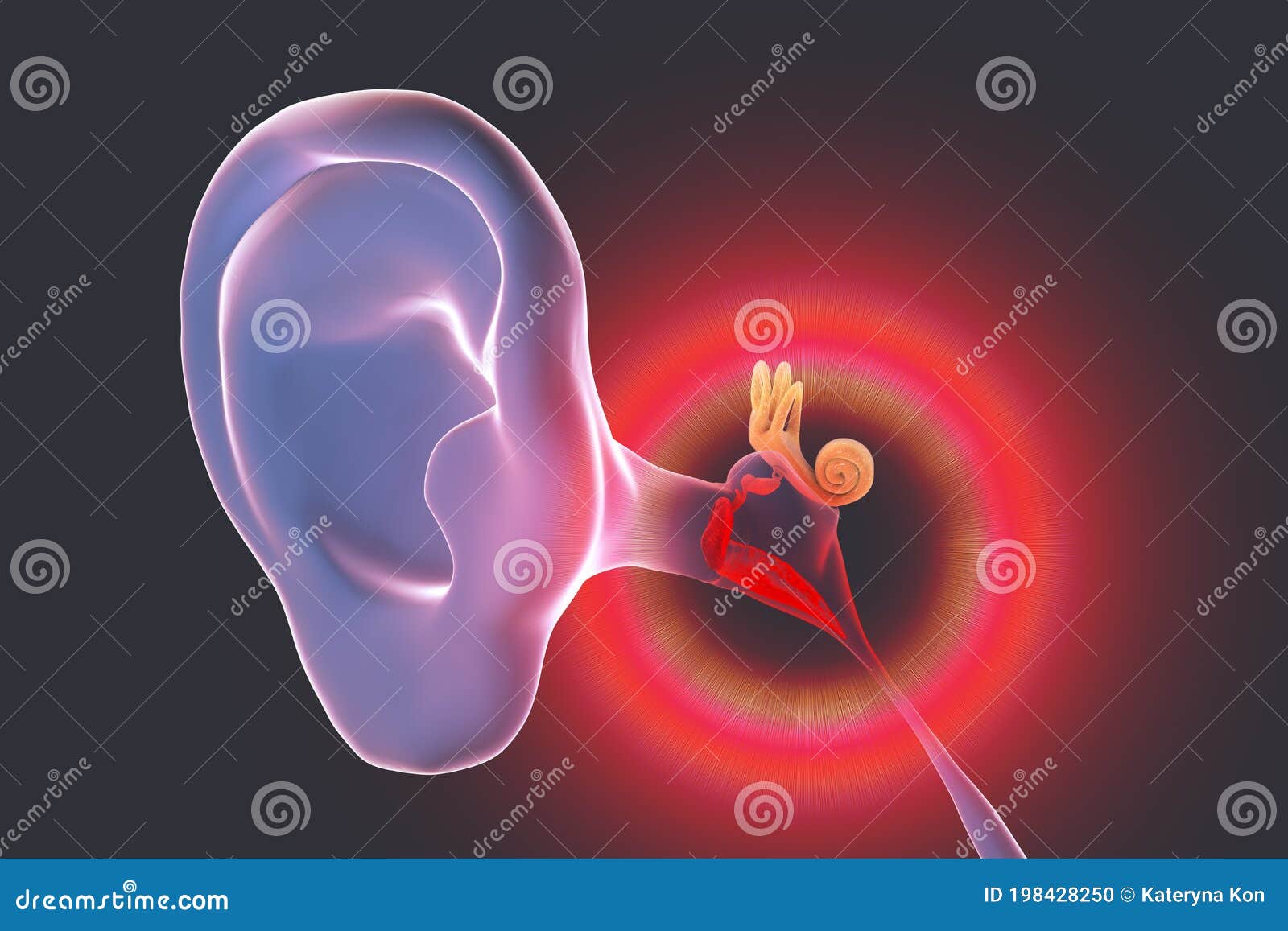 Otitis Media, Illustration | CartoonDealer.com #198428250