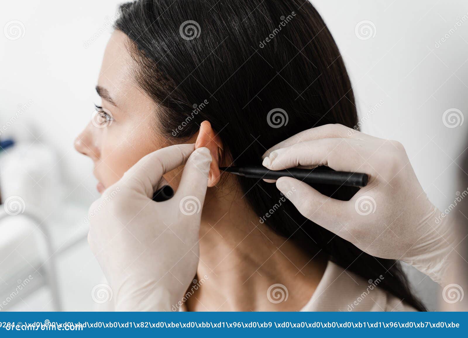 Otoplasty Markup for Surgical Reshaping of the Pinna, or Outer Ear for ...